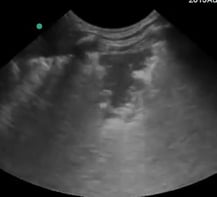 Lung Ultrasound for Pulmonary Thromboembolism: The Vet BLUE® Wedge Sign